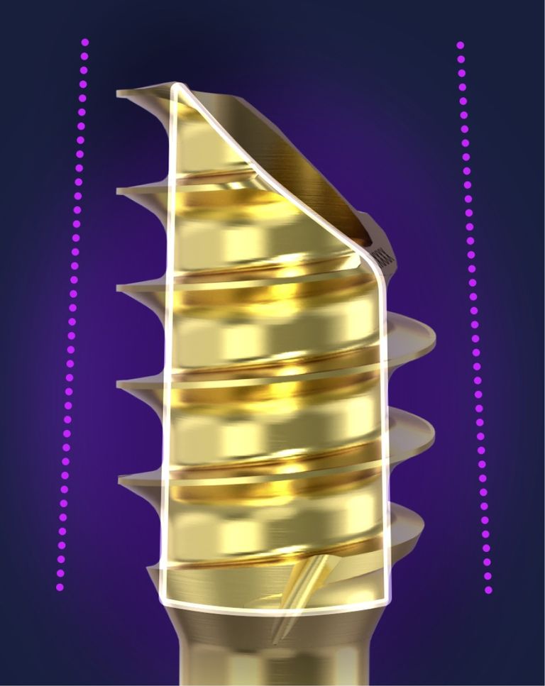 Revcon™ Screw System | Voom™ Medical Devices | Minimally Invasive ...