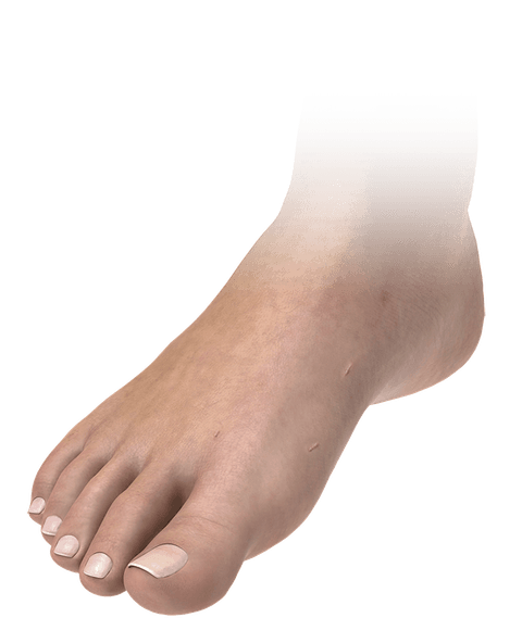 Bunionplasty® 360 Bunion Repair™ | Voom™ Medical Devices | Patent ...