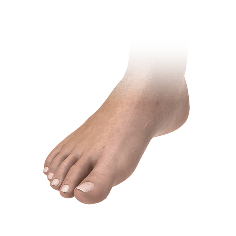 Revcon™ Screw System | Voom™ Medical Devices | Minimally Invasive ...